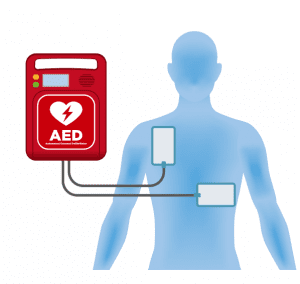 Safety Q&A: How do I use an AED? - Miller Group